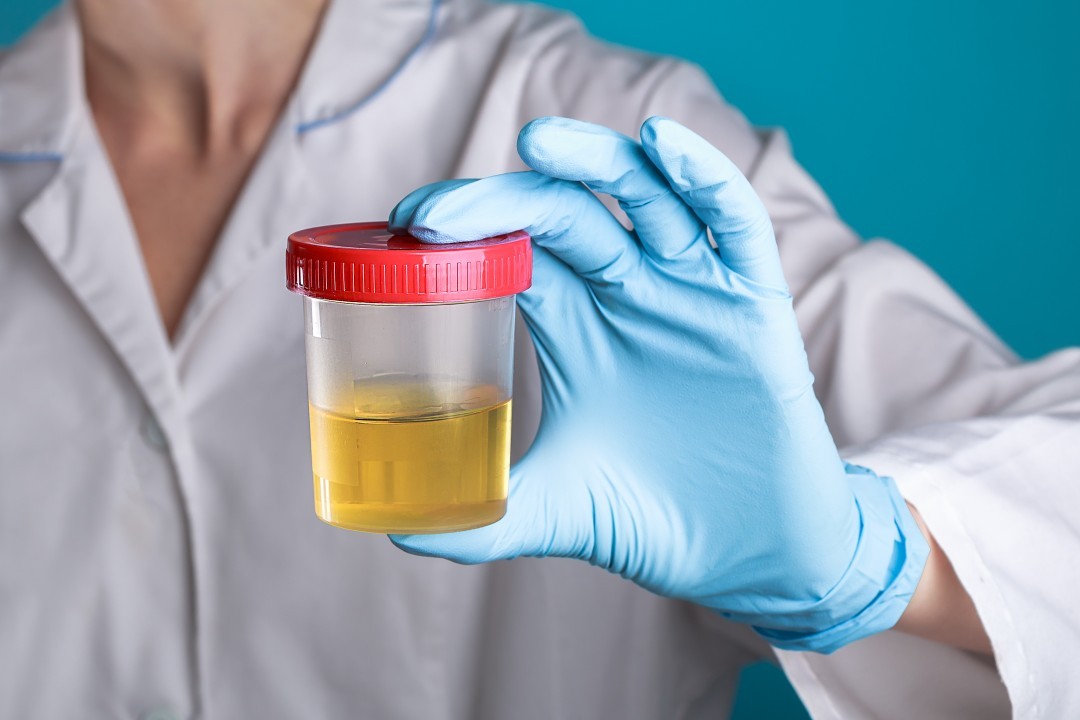 Lysine and Other Amino Acids Market Size, Exploring Share, Trends, and ... Lysine and Other Amino Acids Market Size, Exploring Share, Trends, and ...