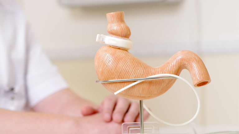 Debunking 9 Myths About Bariatric Surgery Debunking 9 Myths About Bariatric Surgery
