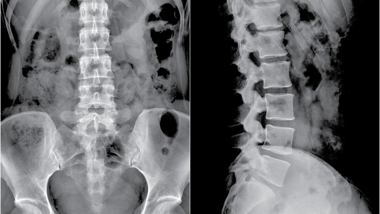 Road to Recovery: Understanding Brain and Spinal Cord Injuries Road to Recovery: Understanding Brain and Spinal Cord Injuries