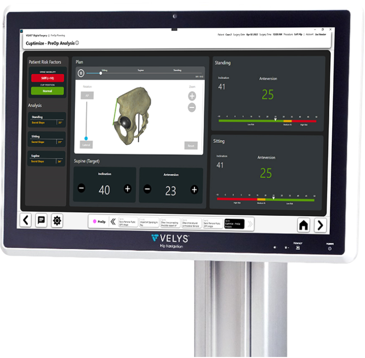Leveraging Data & Imagery to Deliver a More Personalized Hip ... Leveraging Data & Imagery to Deliver a More Personalized Hip ...
