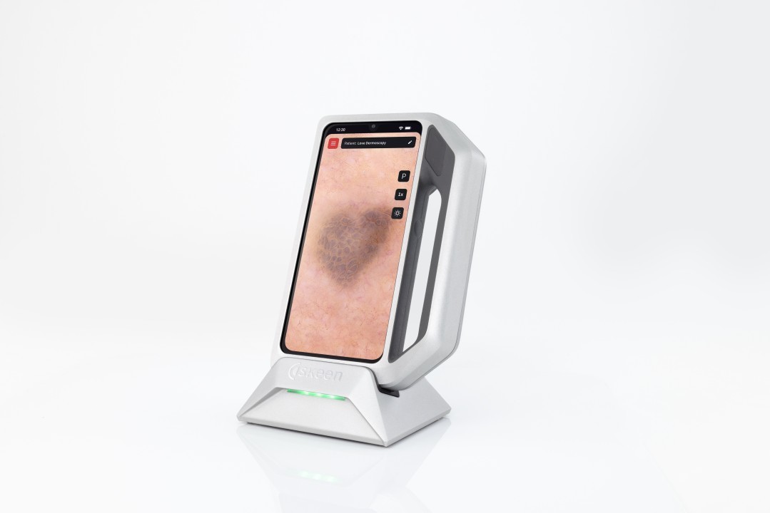Revolution in der Dermatologie: Entdecken Sie das neue FotoFinder Skeen. Revolution in der Dermatologie: Entdecken Sie das neue FotoFinder Skeen.