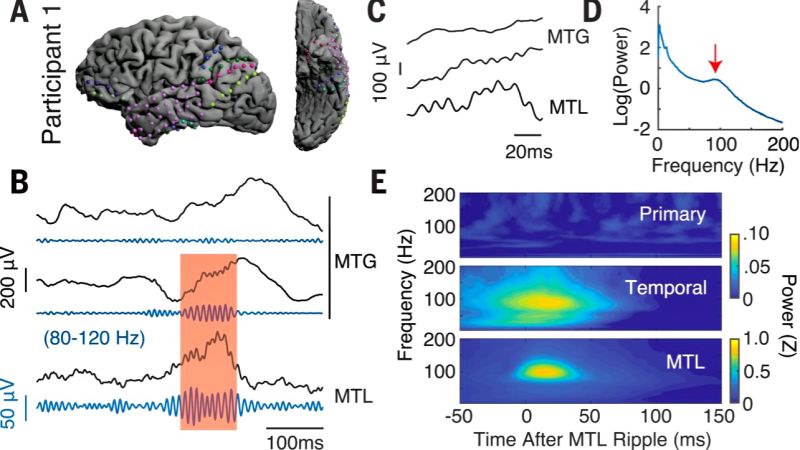 Eveline Ruehlin on LinkedIn: #brain #ripples #memory #neuroscience # ... Eveline Ruehlin on LinkedIn: #brain #ripples #memory #neuroscience # ...