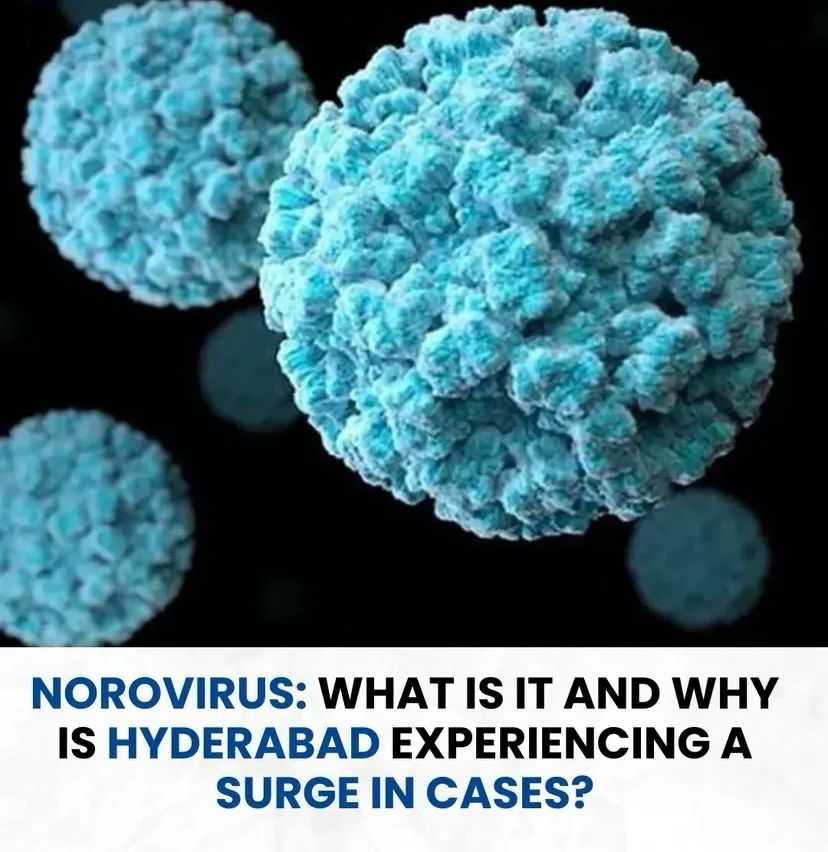 Rachit Prajapati on LinkedIn: What is NOROVIRUS. What is it and why is ... Rachit Prajapati on LinkedIn: What is NOROVIRUS. What is it and why is ...