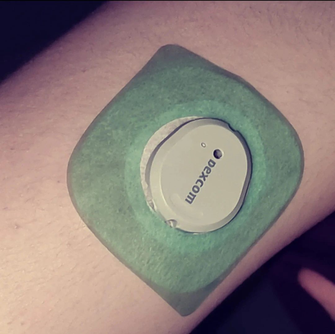 Arlene Rae-Hewitt on LinkedIn: #dexcom #dexcomg6 #dexcomg7 Arlene Rae-Hewitt on LinkedIn: #dexcom #dexcomg6 #dexcomg7