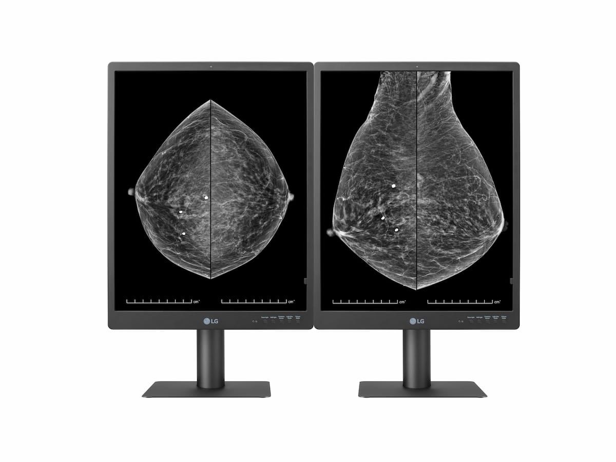 Diagnostic Imaging® on LinkedIn: #mammography #radiology #radres # ... Diagnostic Imaging® on LinkedIn: #mammography #radiology #radres # ...