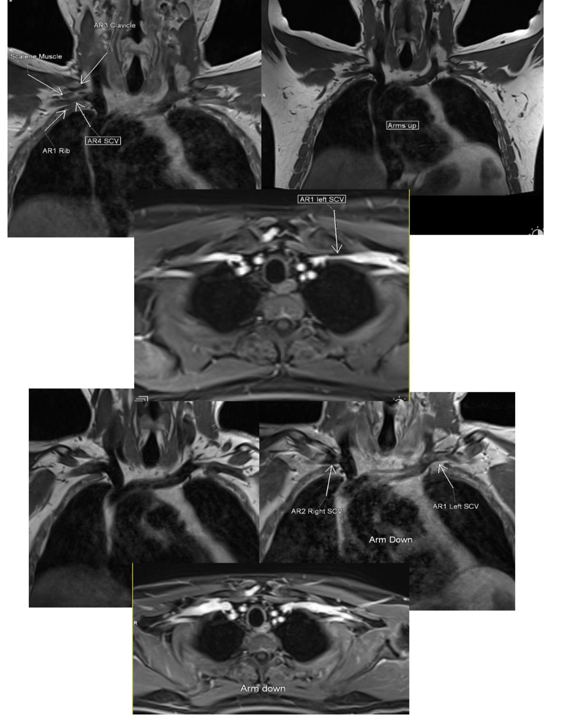 Ahmed Kharabish on LinkedIn: #radiology #radtwitter #thoracic #dynamicmri Ahmed Kharabish on LinkedIn: #radiology #radtwitter #thoracic #dynamicmri