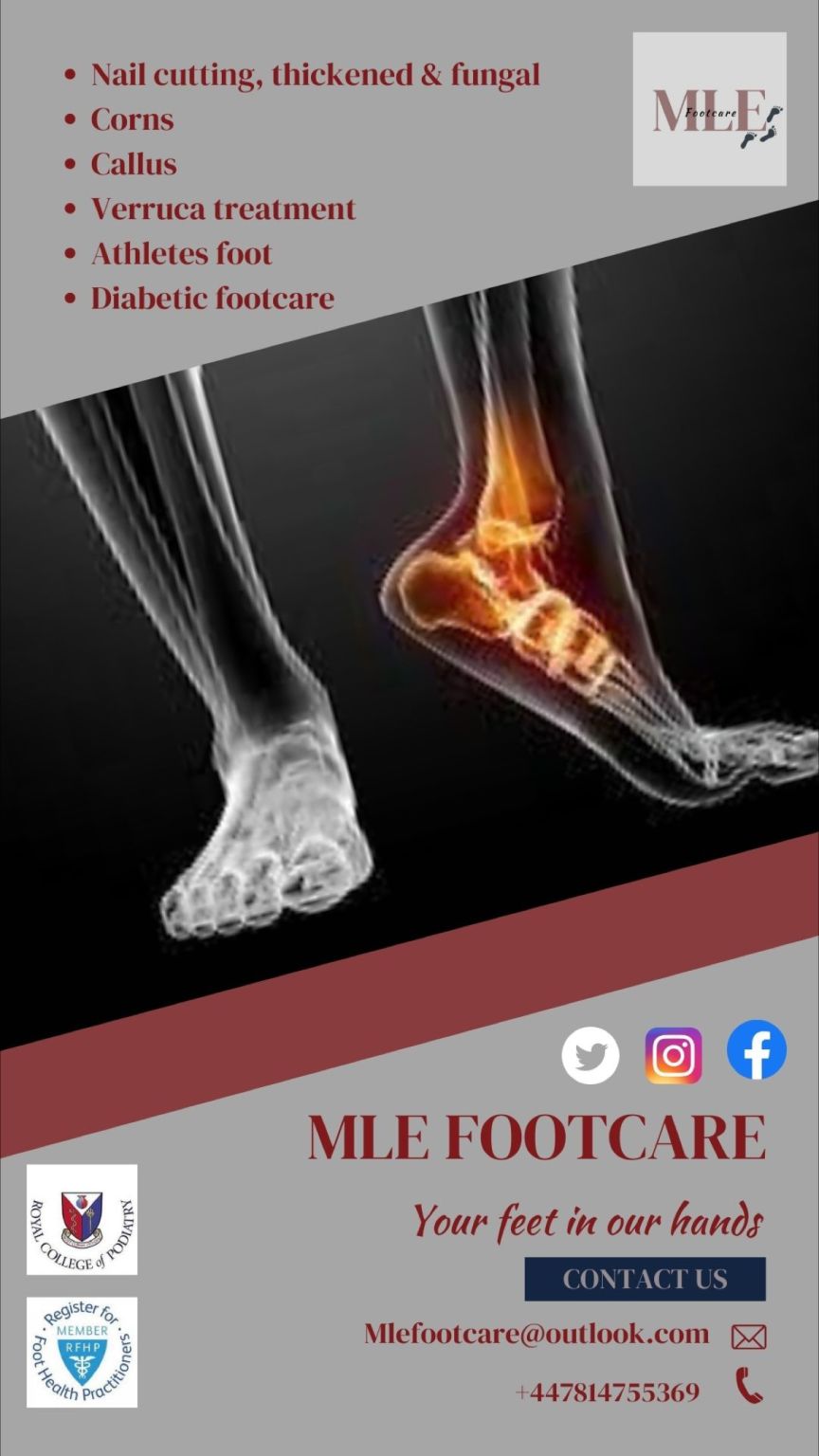 Michelle Edwards on LinkedIn: MLE Footcare Michelle Edwards on LinkedIn: MLE Footcare