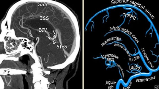 Rida Zainab on LinkedIn: #ctscan Rida Zainab on LinkedIn: #ctscan