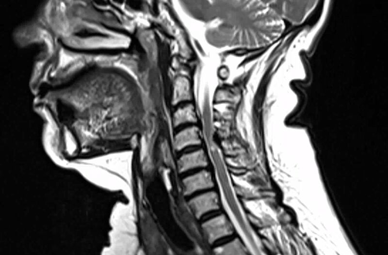 Narendra Rath on LinkedIn: #endoscopicspinesurgery #nhs #nhsengland # ... Narendra Rath on LinkedIn: #endoscopicspinesurgery #nhs #nhsengland # ...