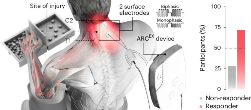 Bioelectronics Drop on LinkedIn: #sci #research #bioelectronics #rehab Bioelectronics Drop on LinkedIn: #sci #research #bioelectronics #rehab