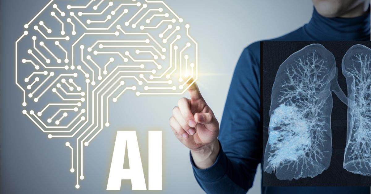 Radiology Business on LinkedIn: Artificial intelligence shows promise ... Radiology Business on LinkedIn: Artificial intelligence shows promise ...