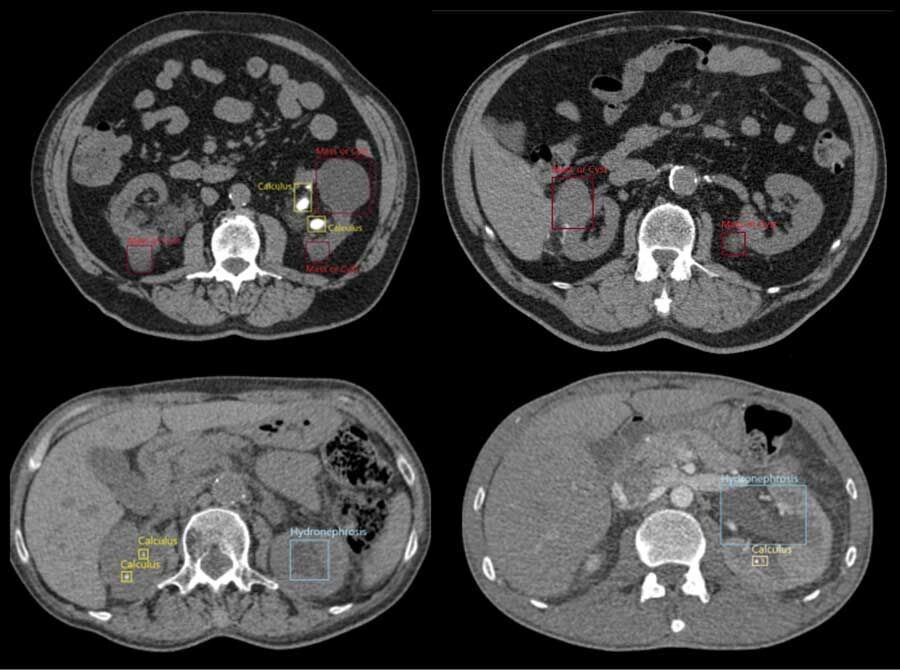 NTT on LinkedIn: NTT DATA completes validation of medical imaging ... NTT on LinkedIn: NTT DATA completes validation of medical imaging ...