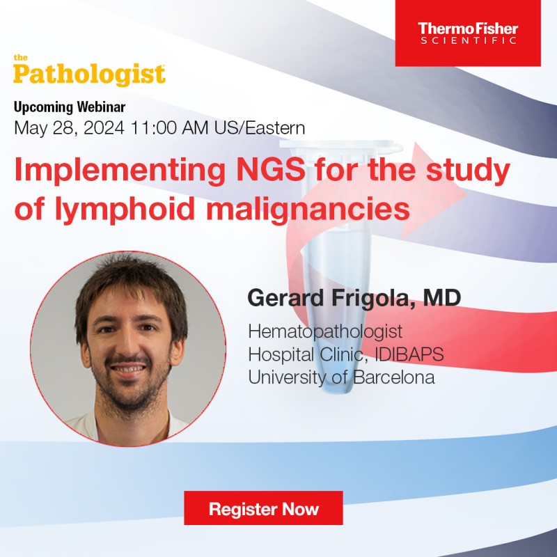 Jeanine Coetzee on LinkedIn: Implementing NGS for the study of lymphoid ... Jeanine Coetzee on LinkedIn: Implementing NGS for the study of lymphoid ...
