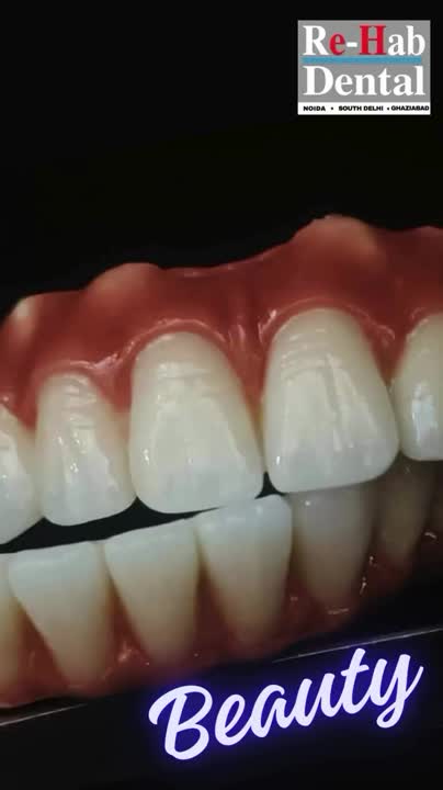 Dr. Rohit Yadav Implant Surgeon on LinkedIn: Wat a beauty ️ Dr Rohit ... Dr. Rohit Yadav Implant Surgeon on LinkedIn: Wat a beauty ️ Dr Rohit ...