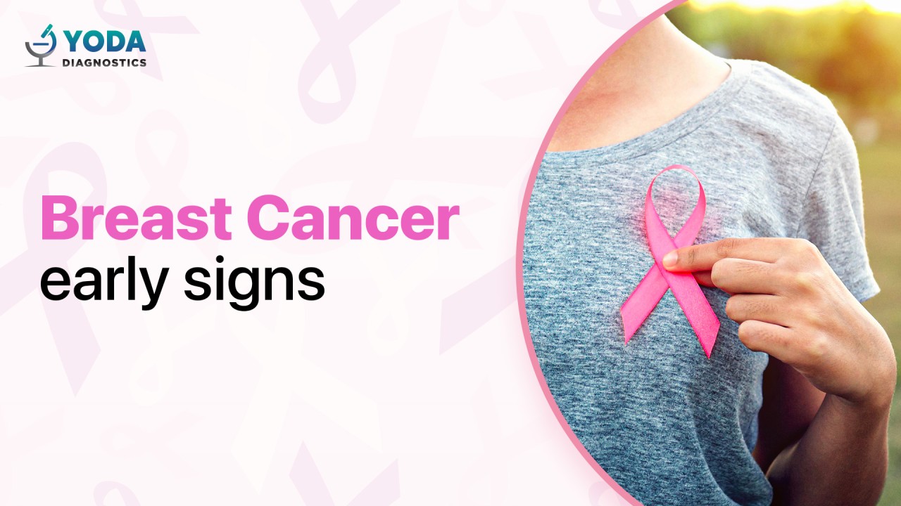 Priya Sharma on LinkedIn: Breast Cancer Early Signs | Breast Cancer ... Priya Sharma on LinkedIn: Breast Cancer Early Signs | Breast Cancer ...