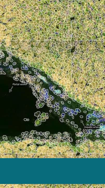 Dxome CLIA Laboratory on LinkedIn: When it comes to single-cell spatial ... Dxome CLIA Laboratory on LinkedIn: When it comes to single-cell spatial ...