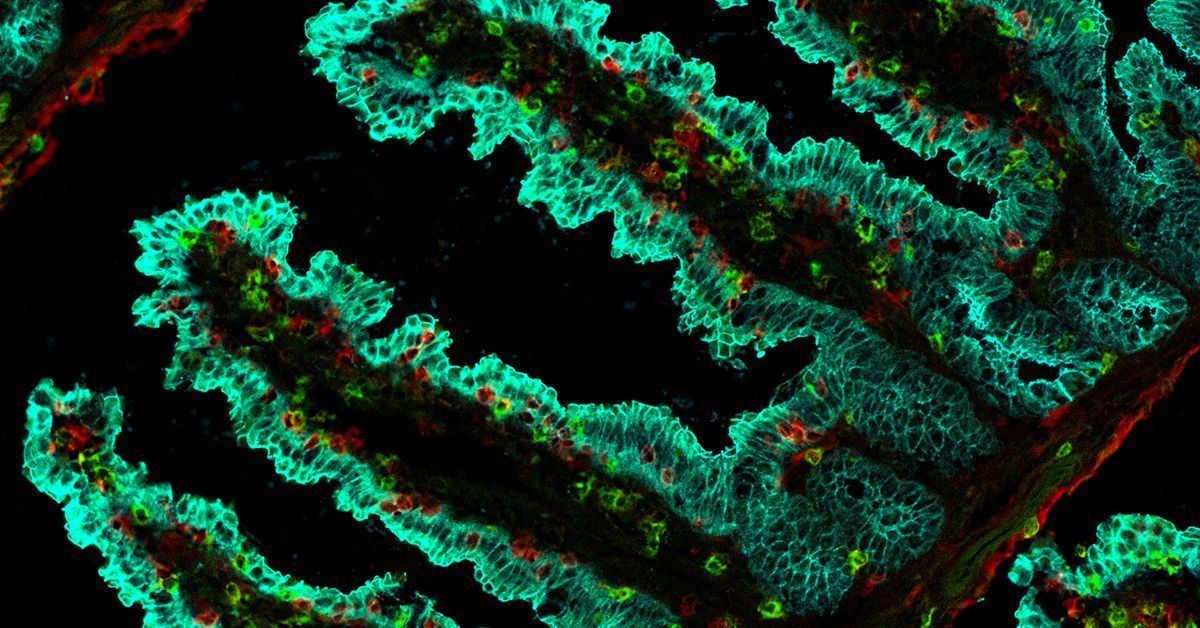 Allen Institute for Immunology on LinkedIn: Enhancing Immune Defenses ... Allen Institute for Immunology on LinkedIn: Enhancing Immune Defenses ...