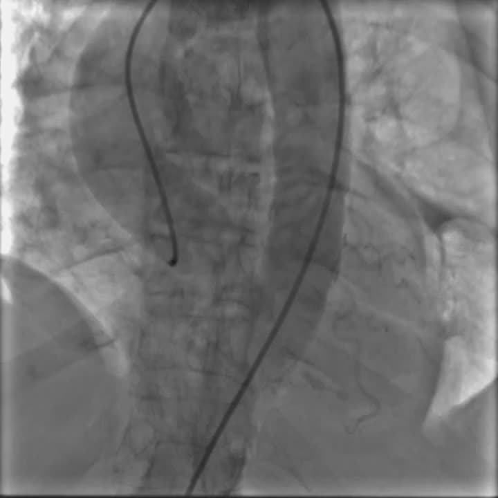 Deepak L. Bhatt, MD, MPH on LinkedIn: #cardiology #cardiovascular Deepak L. Bhatt, MD, MPH on LinkedIn: #cardiology #cardiovascular