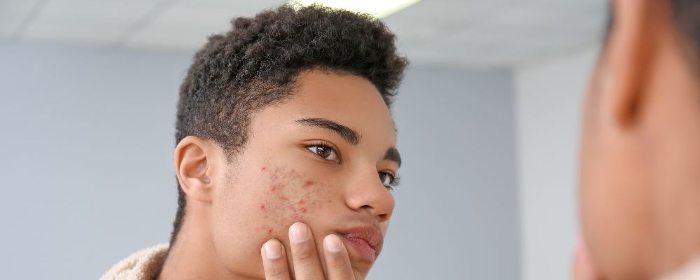 John Barbieri, MD, MBA on LinkedIn: Know the Risks of Acne Antibiotics ... John Barbieri, MD, MBA on LinkedIn: Know the Risks of Acne Antibiotics ...
