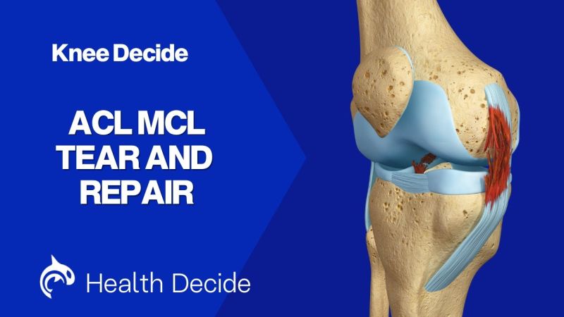 Matt Berry on LinkedIn: This 3D animation depicts a multi-ligament, ACL ... Matt Berry on LinkedIn: This 3D animation depicts a multi-ligament, ACL ...