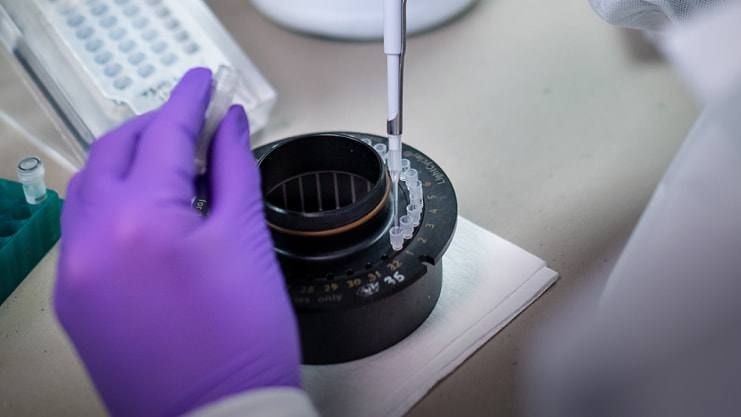 Alex Bollwage on LinkedIn: Invasive fungal infection - Insights Alex Bollwage on LinkedIn: Invasive fungal infection - Insights