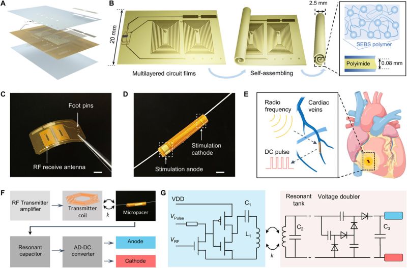Phys.org on LinkedIn: Research team devises an implantable wireless ... Phys.org on LinkedIn: Research team devises an implantable wireless ...