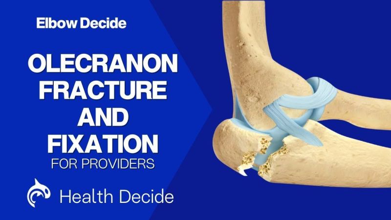 Matt Berry on LinkedIn: Elbow (Olecranon) Fracture and Fixation - (No ... Matt Berry on LinkedIn: Elbow (Olecranon) Fracture and Fixation - (No ...
