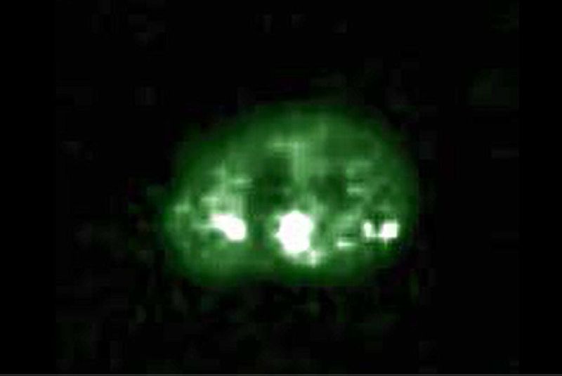 Medical Xpress on LinkedIn: Scientists track 'doubling' in origin of ... Medical Xpress on LinkedIn: Scientists track 'doubling' in origin of ...