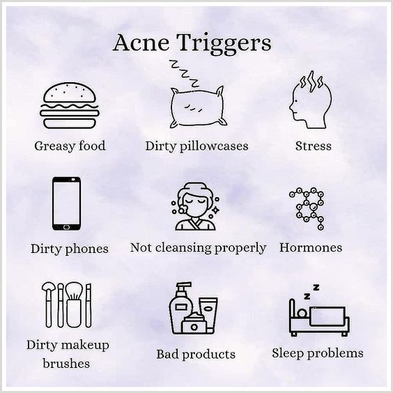 Emily Konatella on LinkedIn: #acne Emily Konatella on LinkedIn: #acne