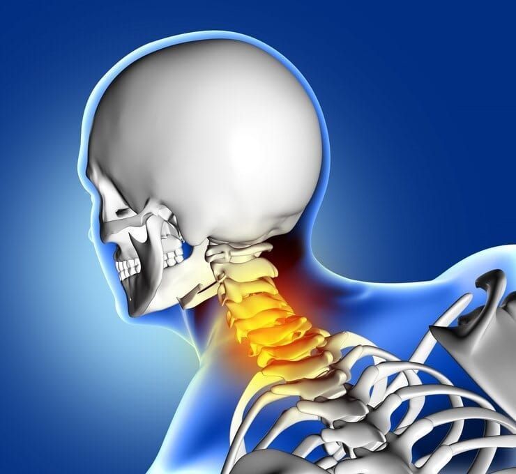 Bourassa Law Group on LinkedIn: Cervical Radiculopathy Car Accident ... Bourassa Law Group on LinkedIn: Cervical Radiculopathy Car Accident ...