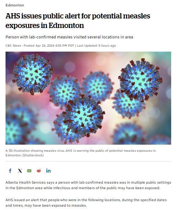 Rithesh Ram on LinkedIn: AHS issues public alert for potential measles ... Rithesh Ram on LinkedIn: AHS issues public alert for potential measles ...