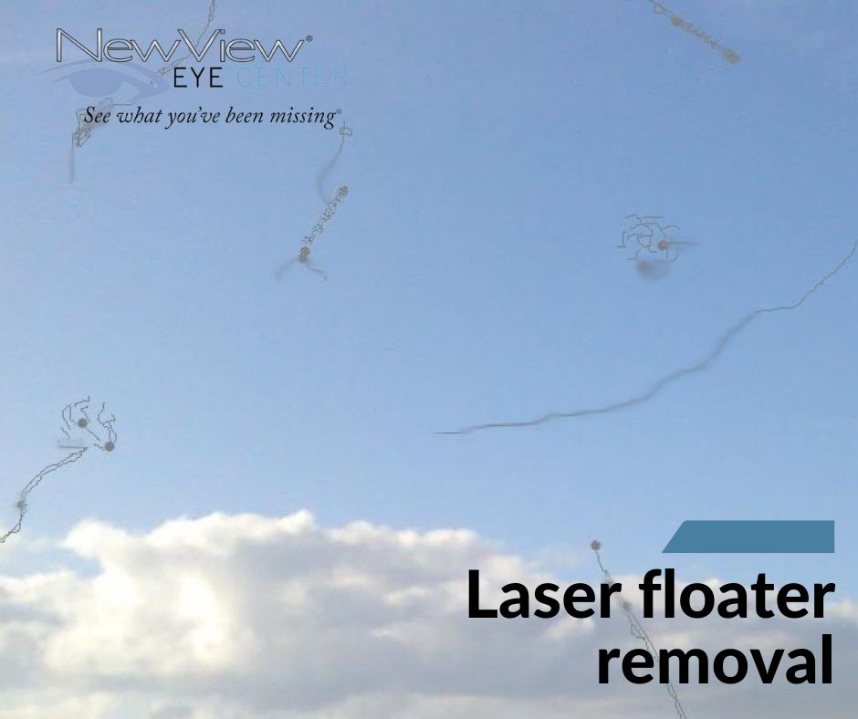 NewView Laser Eye, Inc. on LinkedIn: #vision #newvieweyecenter # ... NewView Laser Eye, Inc. on LinkedIn: #vision #newvieweyecenter # ...
