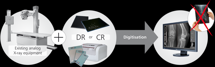 Computed Radiography (CR) vs. Digital Radiography (DR): Which Should ... Computed Radiography (CR) vs. Digital Radiography (DR): Which Should ...
