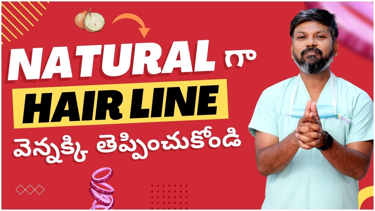 Can I reverse my receding hairline using onion juice, Aloe Vera gel, or ... Can I reverse my receding hairline using onion juice, Aloe Vera gel, or ...