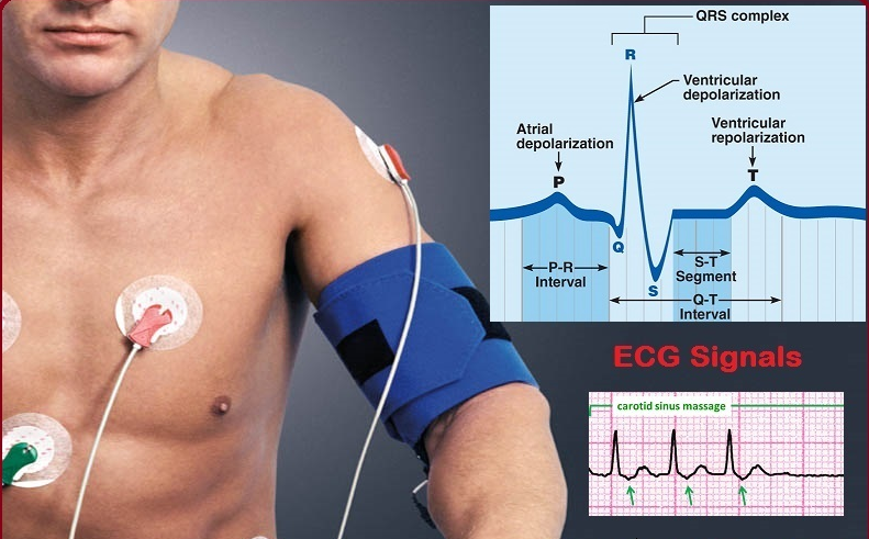 ECG signal processing ECG signal processing