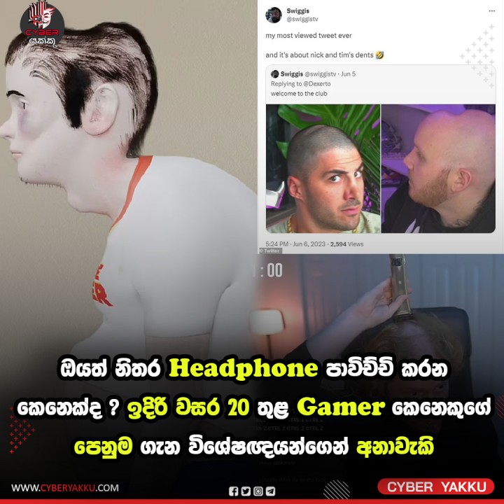 Twitch user finds INDENT on his skull after wearing headphones for hours Twitch user finds INDENT on his skull after wearing headphones for hours