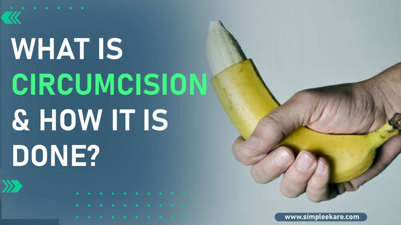 Understanding the Basics of Circumcision: What It Is and How It’s Done Understanding the Basics of Circumcision: What It Is and How It’s Done