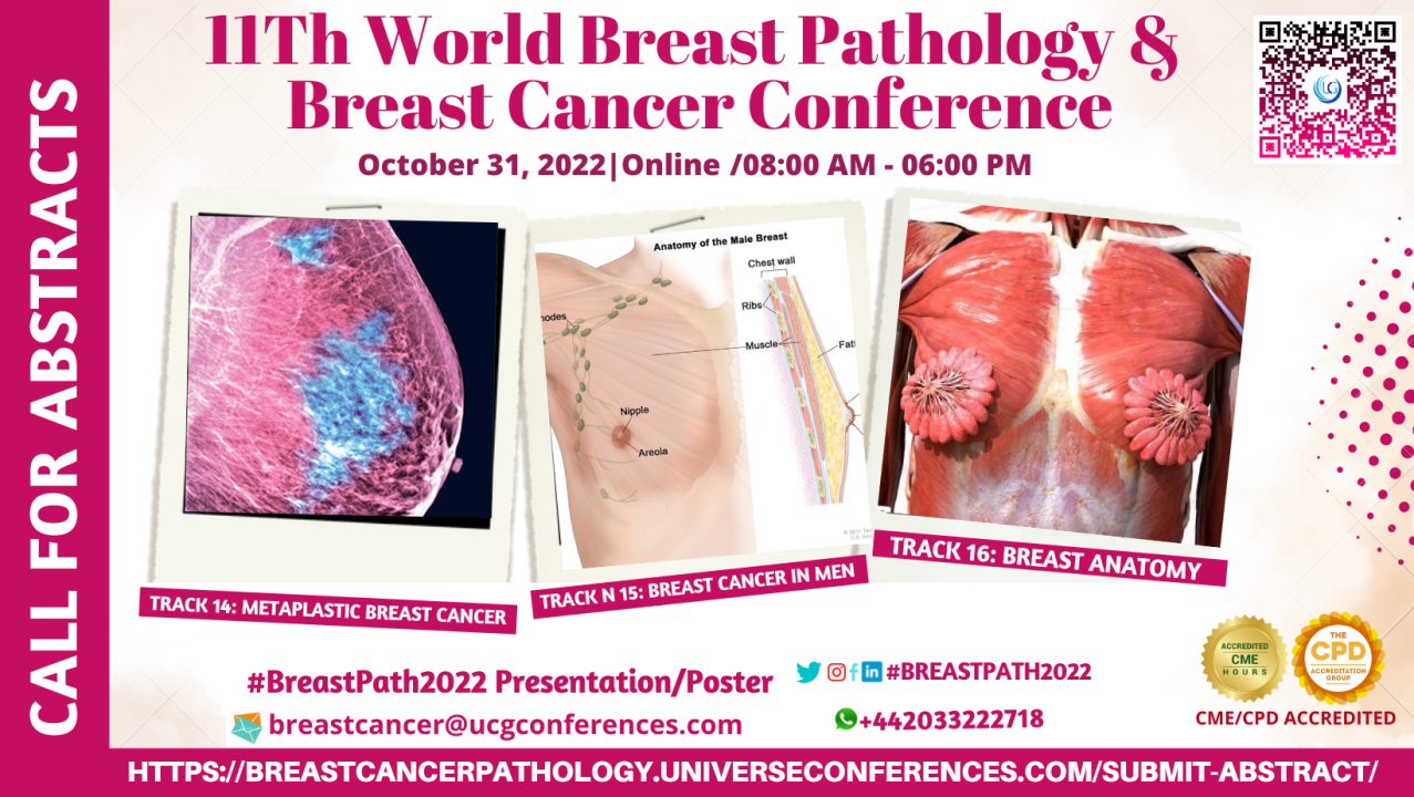 Breast cancer classification Breast cancer classification