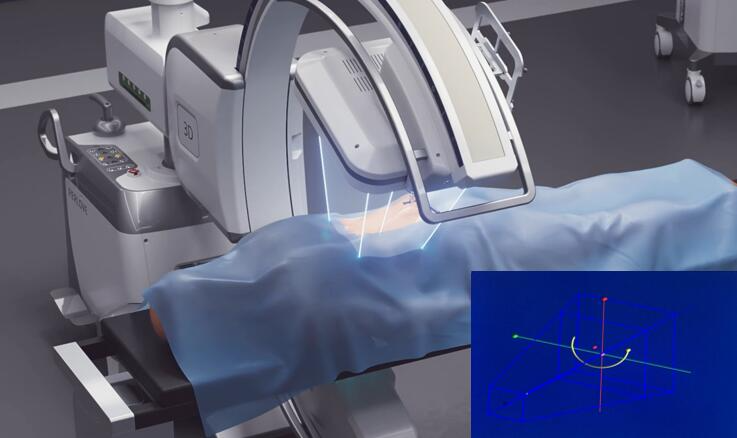 What’s the difference between navigation and localization in surgical ... What’s the difference between navigation and localization in surgical ...