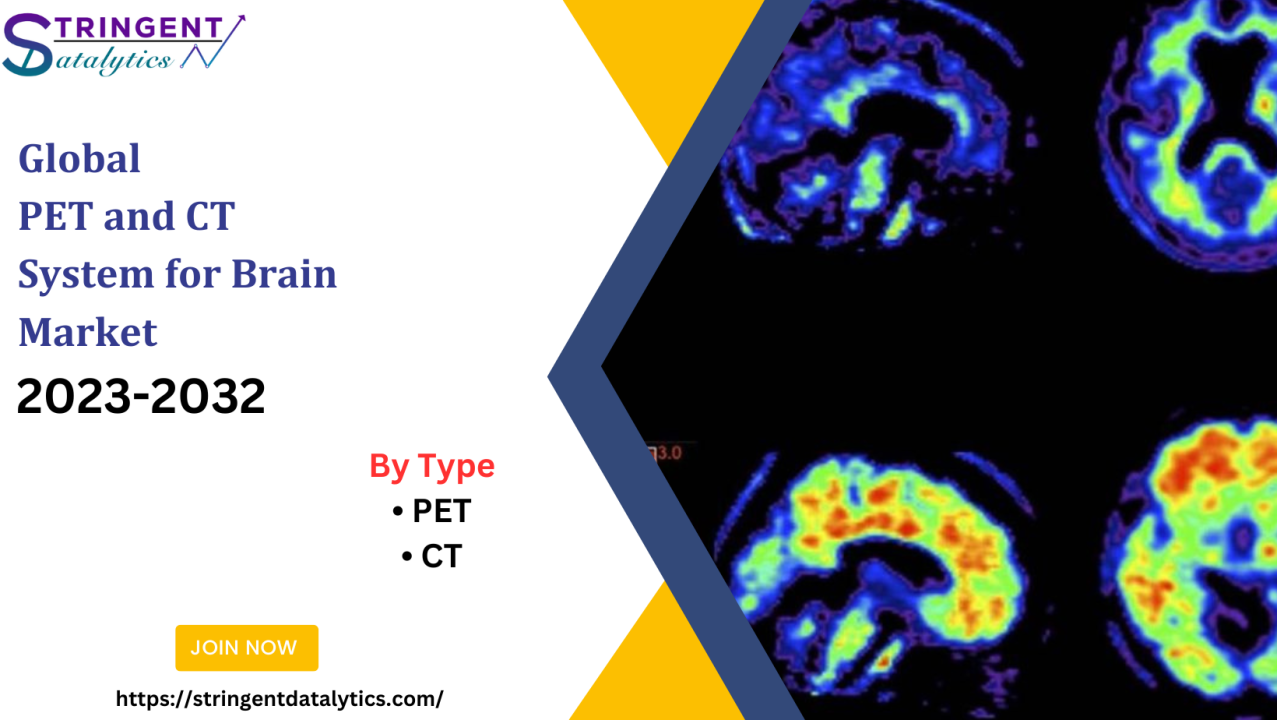Brain Imaging Precision: Navigating Trends in the PET and CT System for ... Brain Imaging Precision: Navigating Trends in the PET and CT System for ...