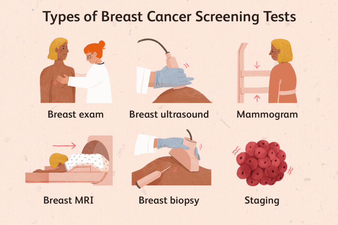 Breast Cancer Screening Tests Market by Technology Innovation and Growth Breast Cancer Screening Tests Market by Technology Innovation and Growth
