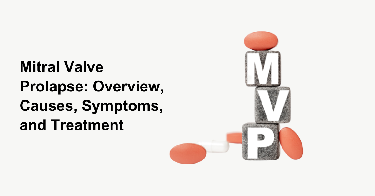 Mitral Valve Prolapse: Overview, Causes, Symptoms, and Treatment Mitral Valve Prolapse: Overview, Causes, Symptoms, and Treatment