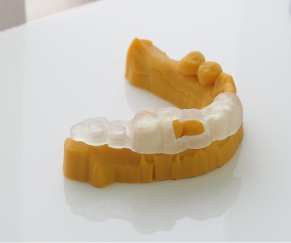 3D Printed Surgical guides 3D Printed Surgical guides