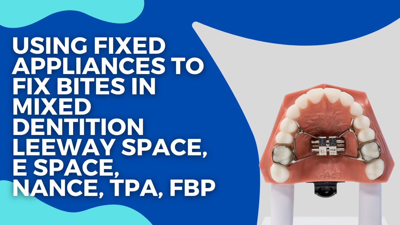 Using Fixed Appliances to Fix Bites in Mixed Dentition- Leeway Space, E ... Using Fixed Appliances to Fix Bites in Mixed Dentition- Leeway Space, E ...