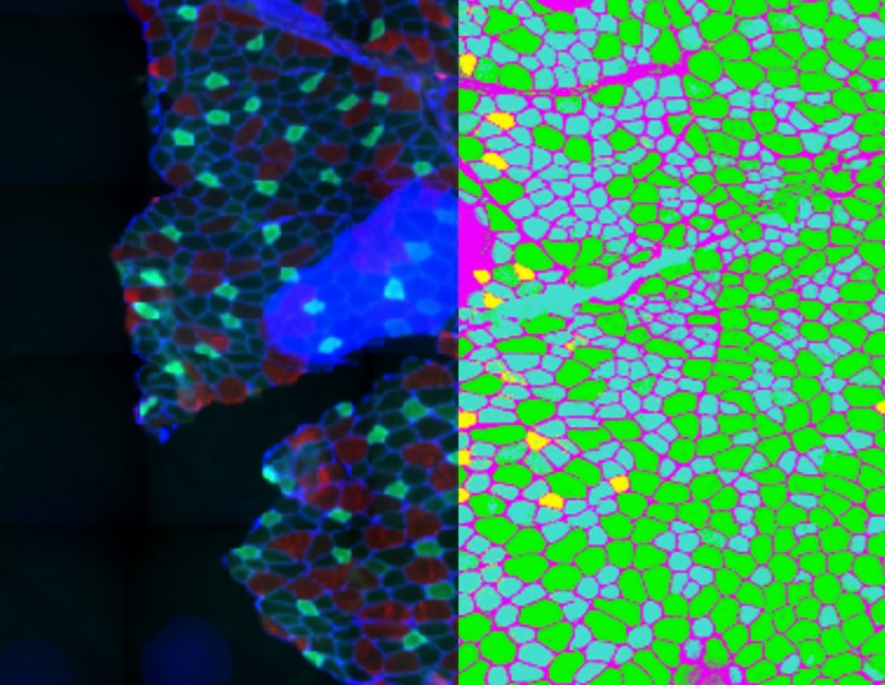 ZEISS Microscopy on LinkedIn: Carl Zeiss Microscopy Deutschland GmbH ... ZEISS Microscopy on LinkedIn: Carl Zeiss Microscopy Deutschland GmbH ...