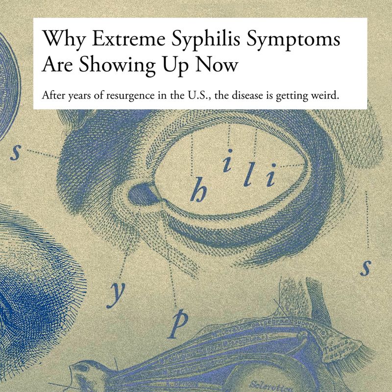 NOWDiagnostics | NOWDx on LinkedIn: #ocular #syphilis #nowdx # ... NOWDiagnostics | NOWDx on LinkedIn: #ocular #syphilis #nowdx # ...