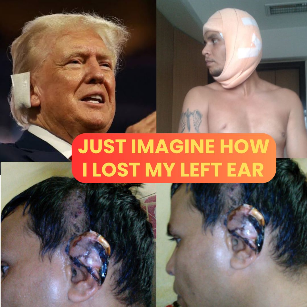 Praveen Kumar Teotia on LinkedIn: Just imagine... How I lost my left ... Praveen Kumar Teotia on LinkedIn: Just imagine... How I lost my left ...