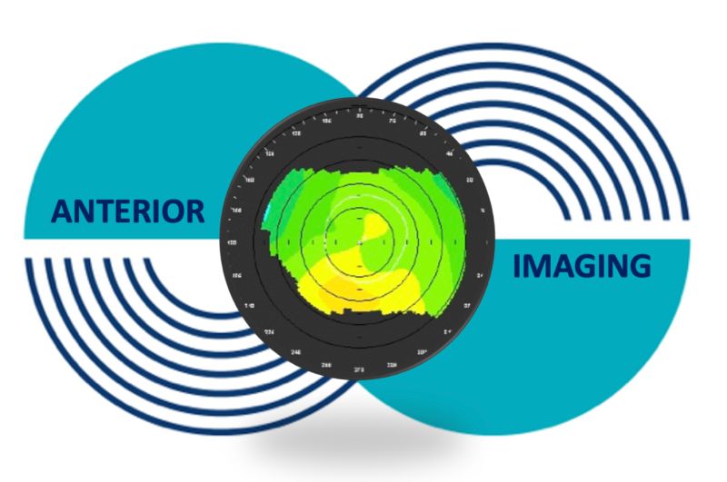 Art of Ocular Imaging on LinkedIn: #anteriorimaging #ocularimaging # ... Art of Ocular Imaging on LinkedIn: #anteriorimaging #ocularimaging # ...