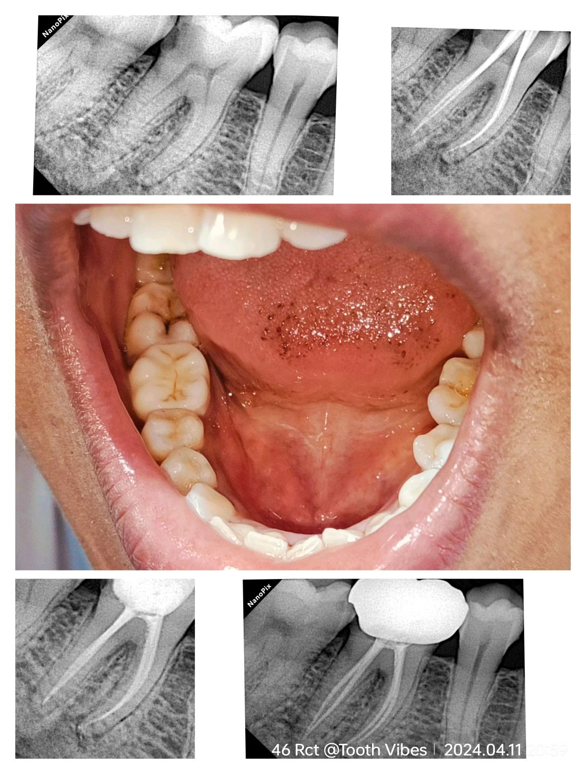 Dr. Aditya Narayanan on LinkedIn: #smile Dr. Aditya Narayanan on LinkedIn: #smile