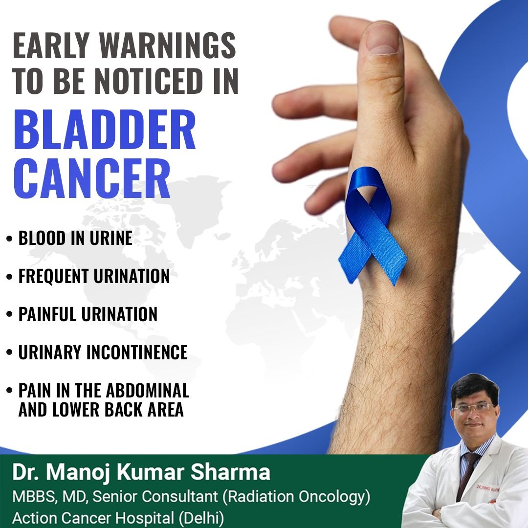 Dr. Manoj Sharma: Early detection and treatment for bladder cancer | Dr ... Dr. Manoj Sharma: Early detection and treatment for bladder cancer | Dr ...
